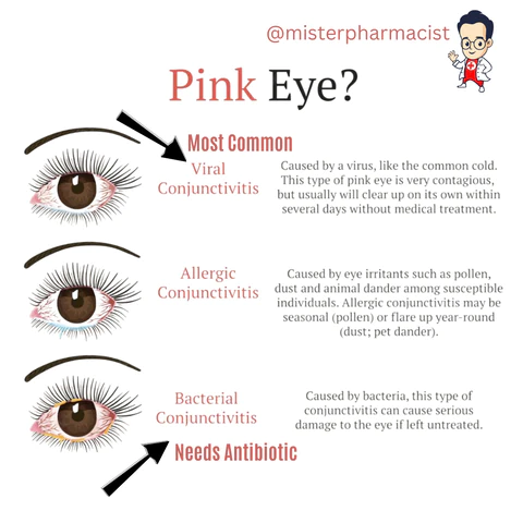 Pink Eye (Conjunctivitis)